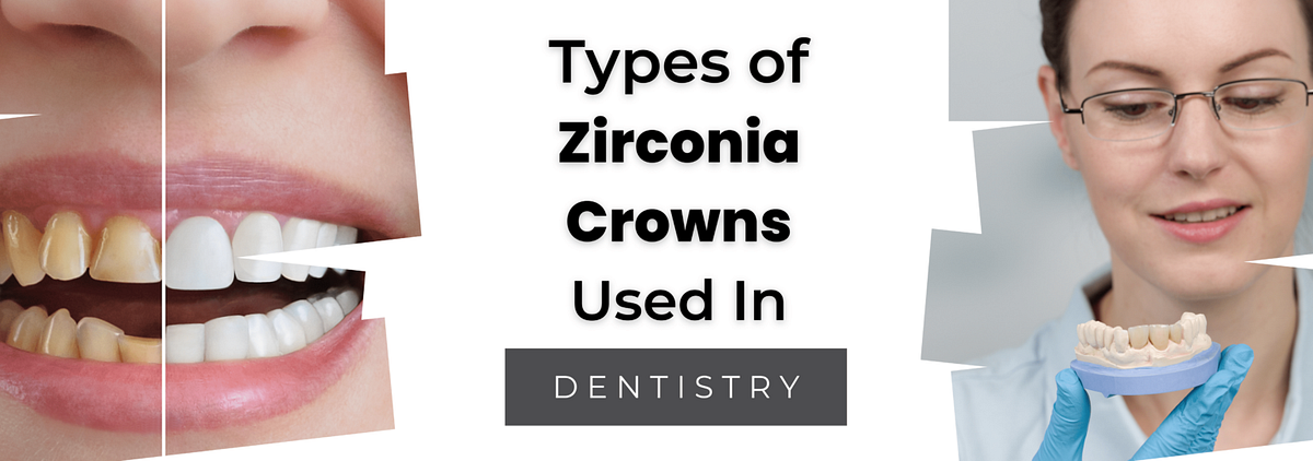 Types Of Zirconia Crown. In this post I will tell you about the… | by ...