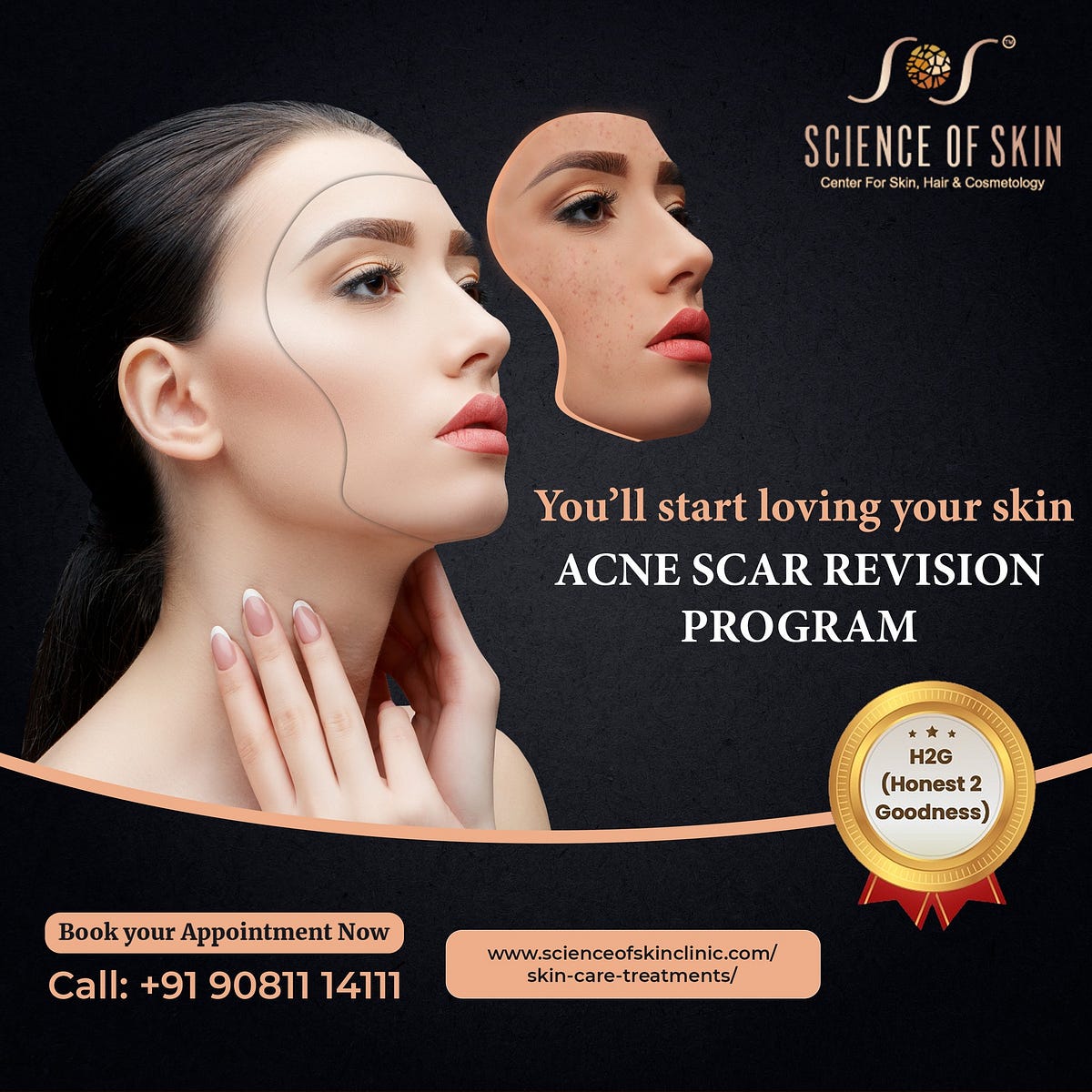 Best Skin Clinic in Hyderabad |Skin specialists in hyderabad | Best ...