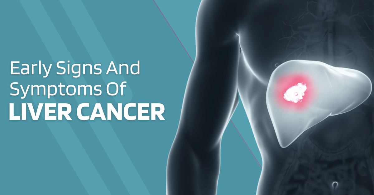 EARLY SIGNS AND SYMPTOMS OF LIVER CANCER - Dr. Mark D'Andrea - Medium