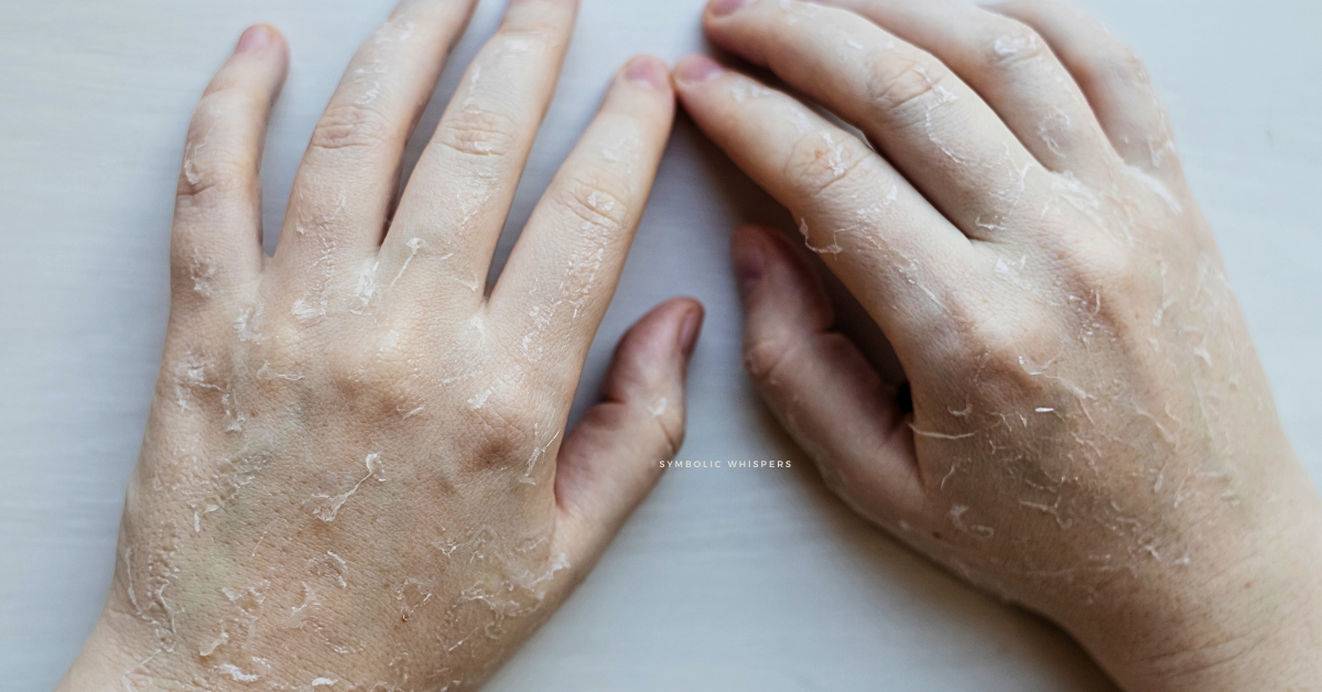 The Spiritual Meaning of Peeling Skin on Hands! | Astro Pagan