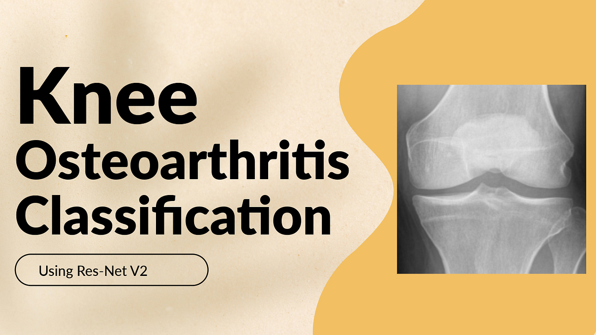 I Built an AI to Grade Knee Osteoarthritis: A ResNet152V2 Deep Dive ...