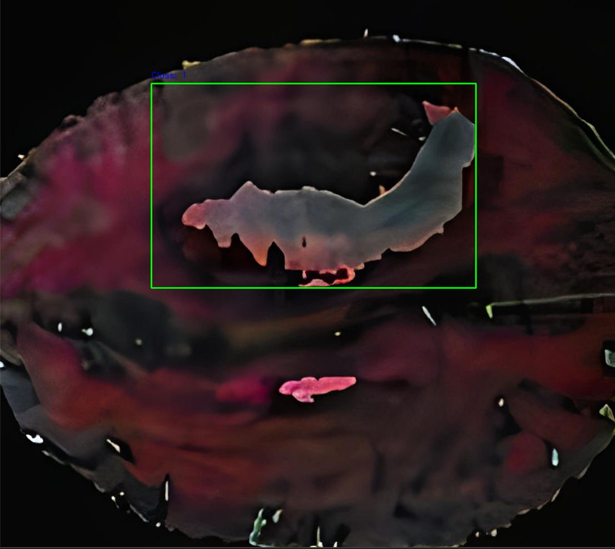 Tumor Detection Using Yolo And Super Resolution Techniques By Gehna Ahuja Dec 2024 Medium