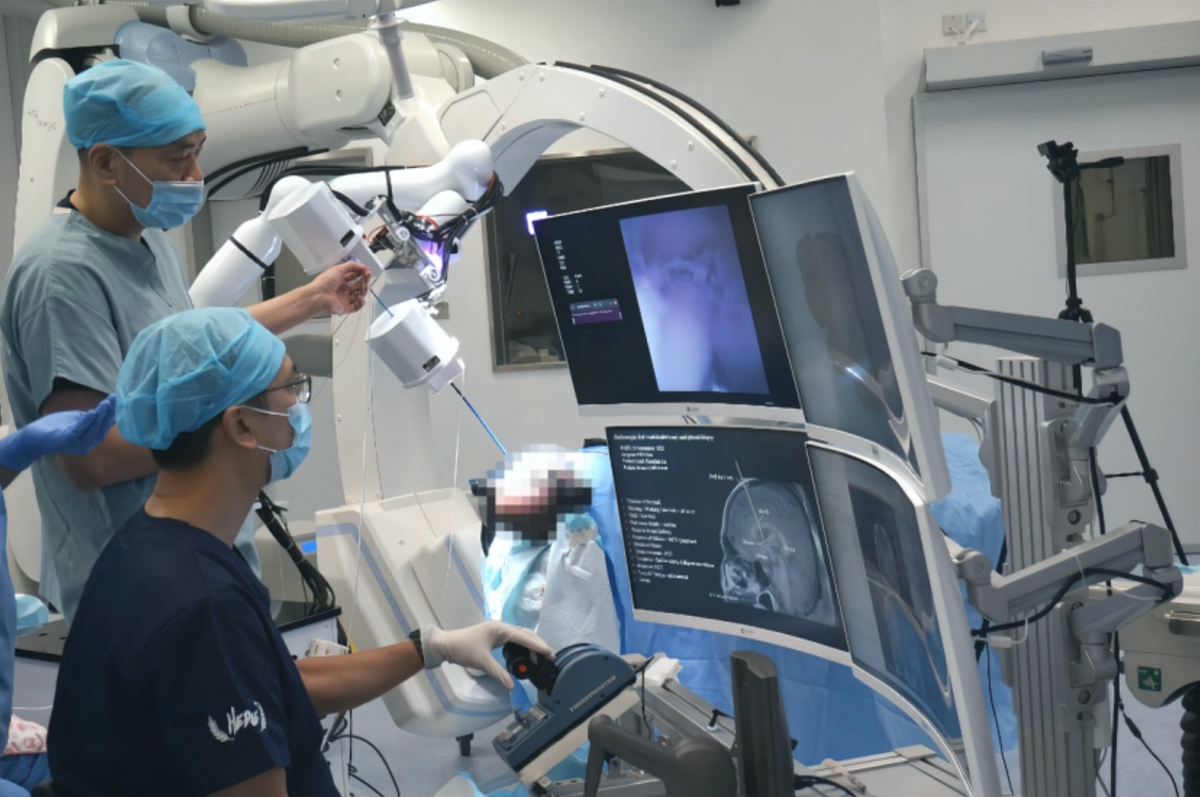 Robots in Your Brain. AI is transforming brain tumor surgery… | by ...