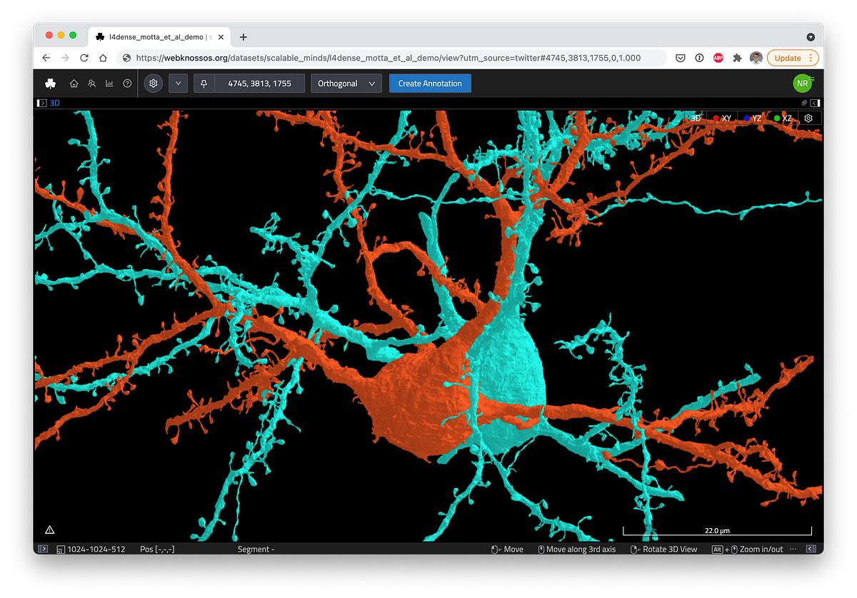 Introducing 3D meshes for segmentations in webKnossos | by Norman Rzepka | WEBKNOSSOS | Medium