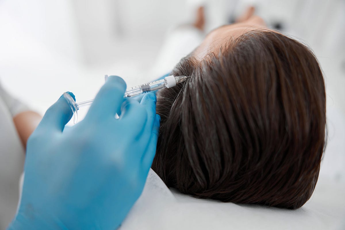 The Science Behind PRP Hair Treatment: How It Works | by Dr. Neha ...