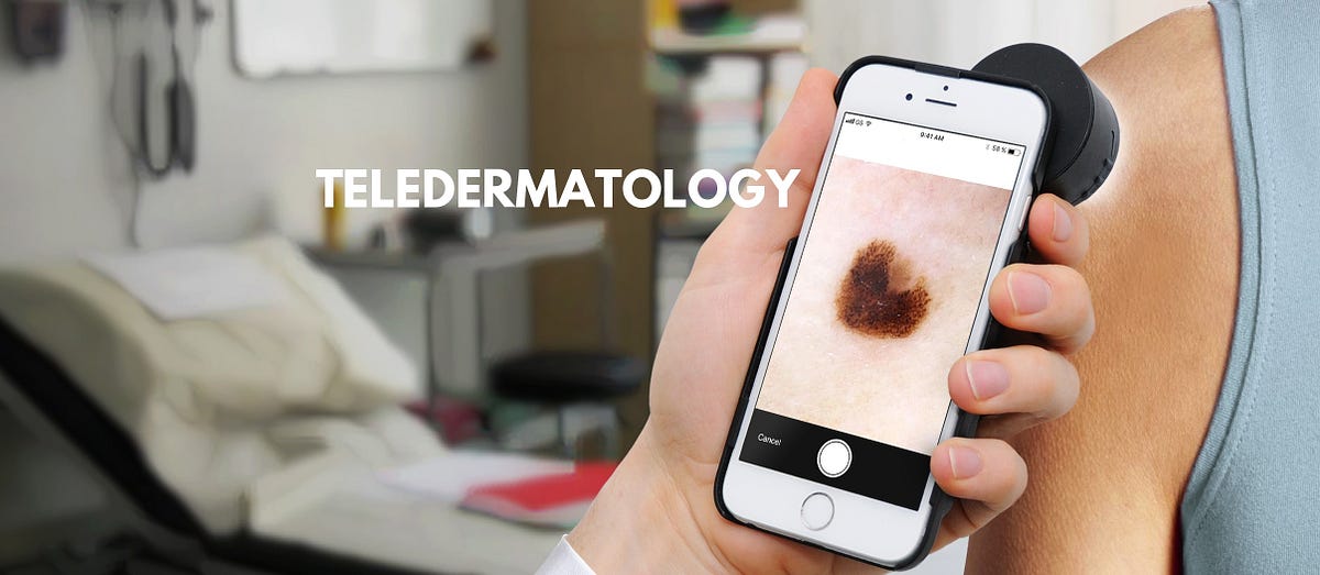 TeledermatologyTeledermatology Specializes In Real-Time or Live ...