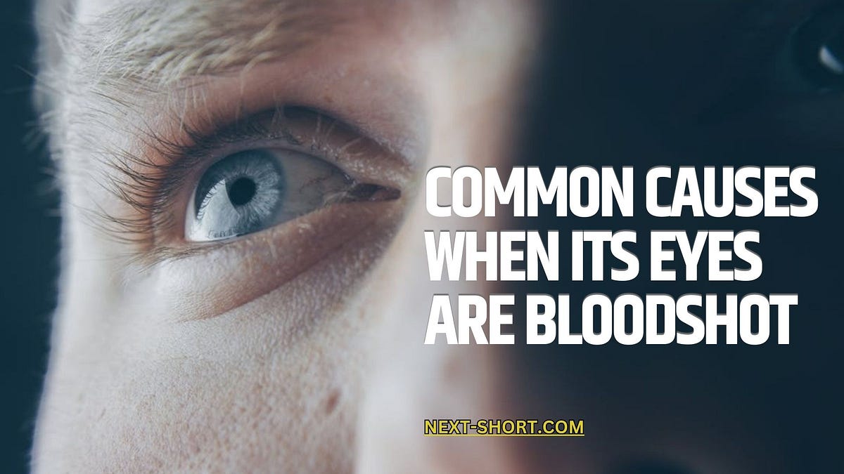 Common Causes When Its Eyes Are Bloodshot | by Mark Pickett | Jul, 2024 | Medium