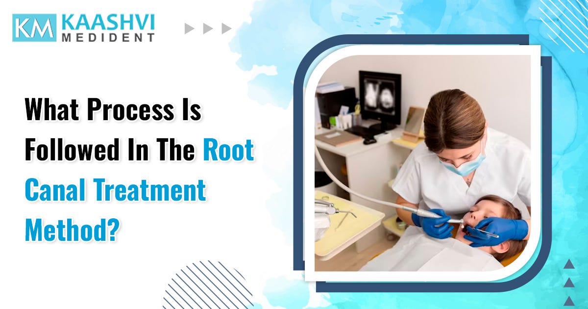 What Process Is Followed In The Root Canal Treatment Method? | by Adi ...