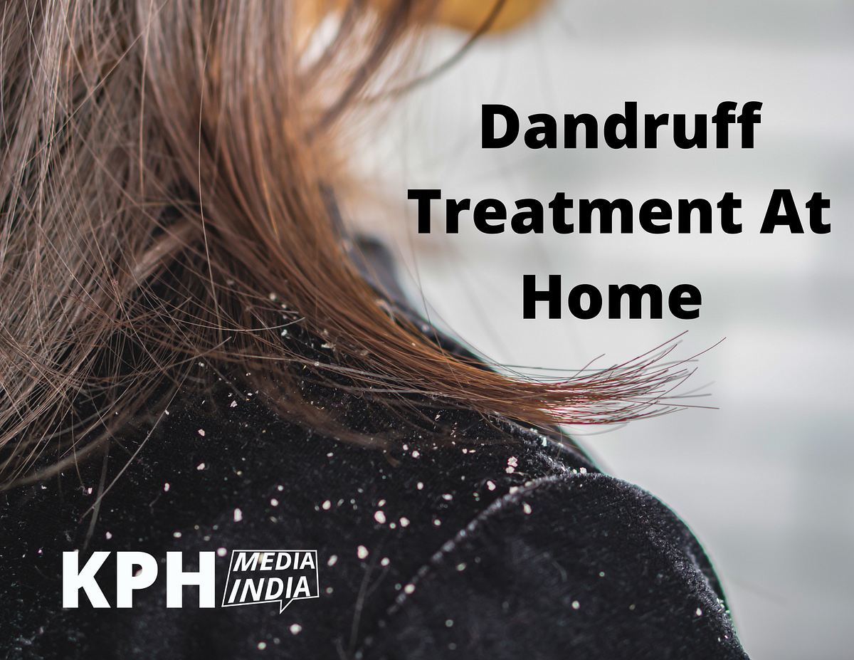 Dandruff Treatment At Home | KPH Media India - Kphmediaindia - Medium