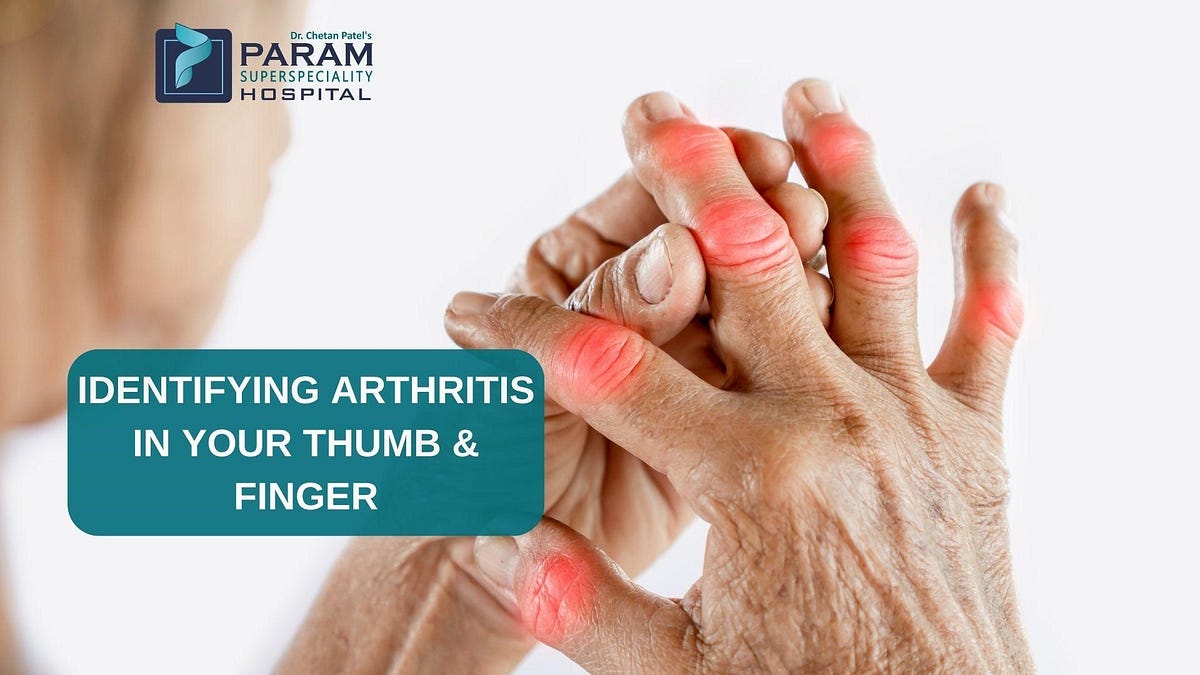 Identifying Arthritis in Your Fingers and Thumbs By The Best Thumb ...