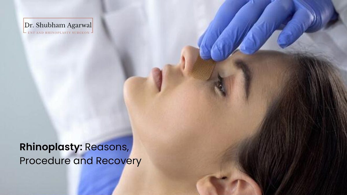 Rhinoplasty: Reasons, Procedure and Recovery | by Dr. Shubham Agarwal ...