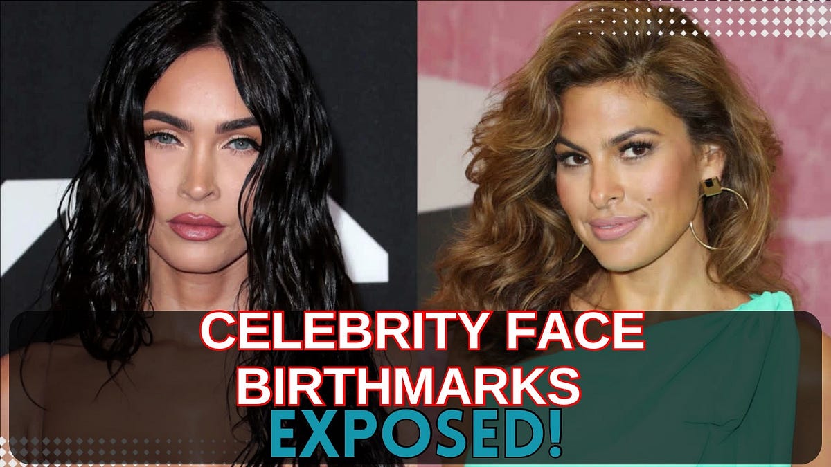 The truth behind famous faces birthmarks - Uln Bro - Medium
