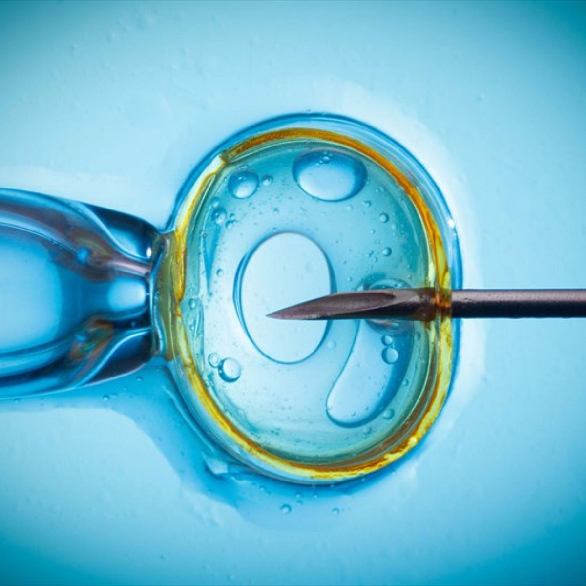 Exploring the Success Rates of ICSI Treatment: What You Need to Know ...