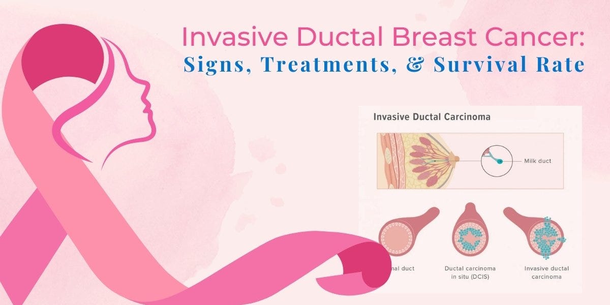 INVASIVE DUCTAL BREAST CANCER: SIGNS, TREATMENTS, & SURVIVAL RATE - Dr ...