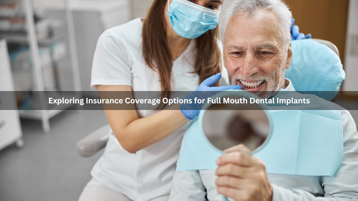 Exploring Insurance Coverage Options for Full Mouth Dental Implants ...