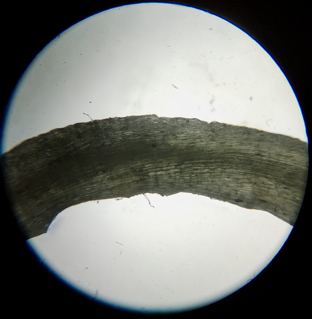 Microscopy: Roots, Root-Squash, and Fungus - Shrean Rafiq - Medium