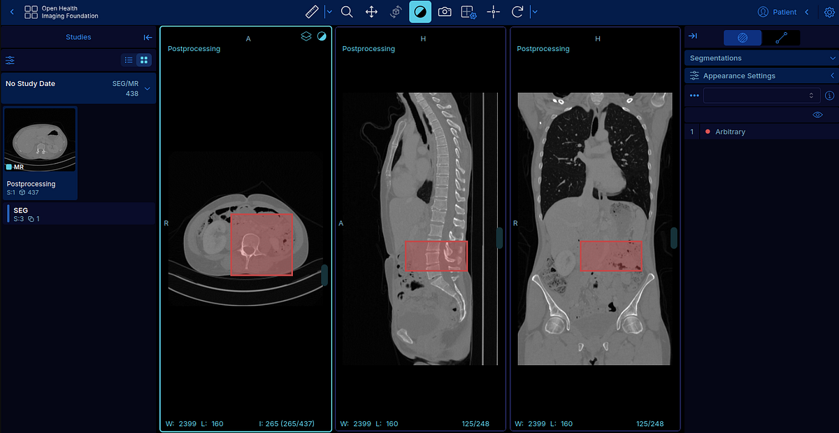Step By Step Guide: Convert Your Segmentation Mask To DICOM-SEG ...