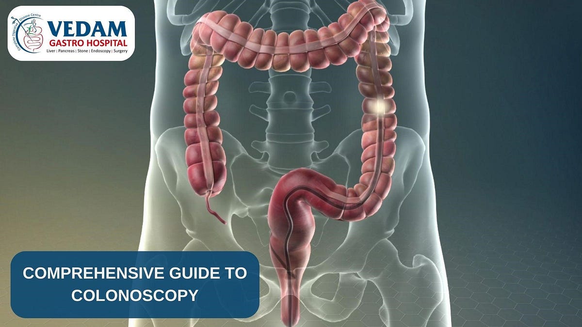 Comprehensive Guide to Colonoscopy:Procedure, Benefits, and Expert Care ...