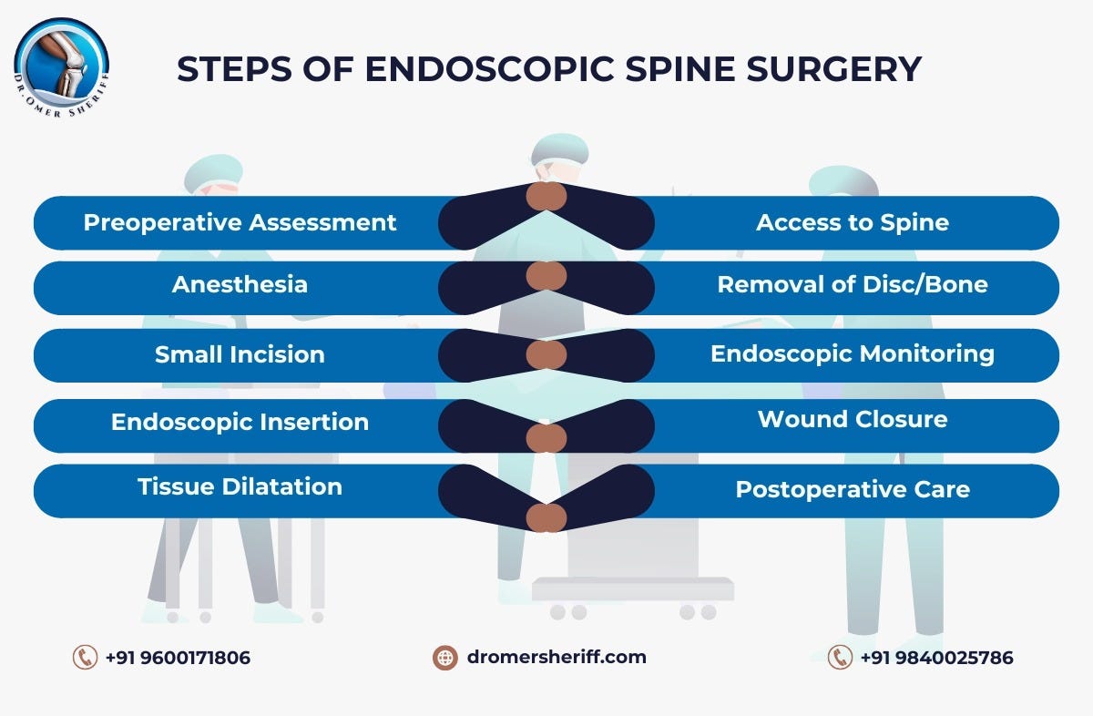 Laser Spine Surgery in Chennai. Laser spine surgery in Chennai has ...