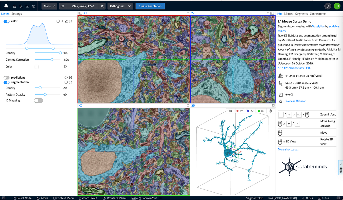 Data Streaming with webKnossos Libs | by Albane le Tournoulx de la Villegeorges | WEBKNOSSOS ...