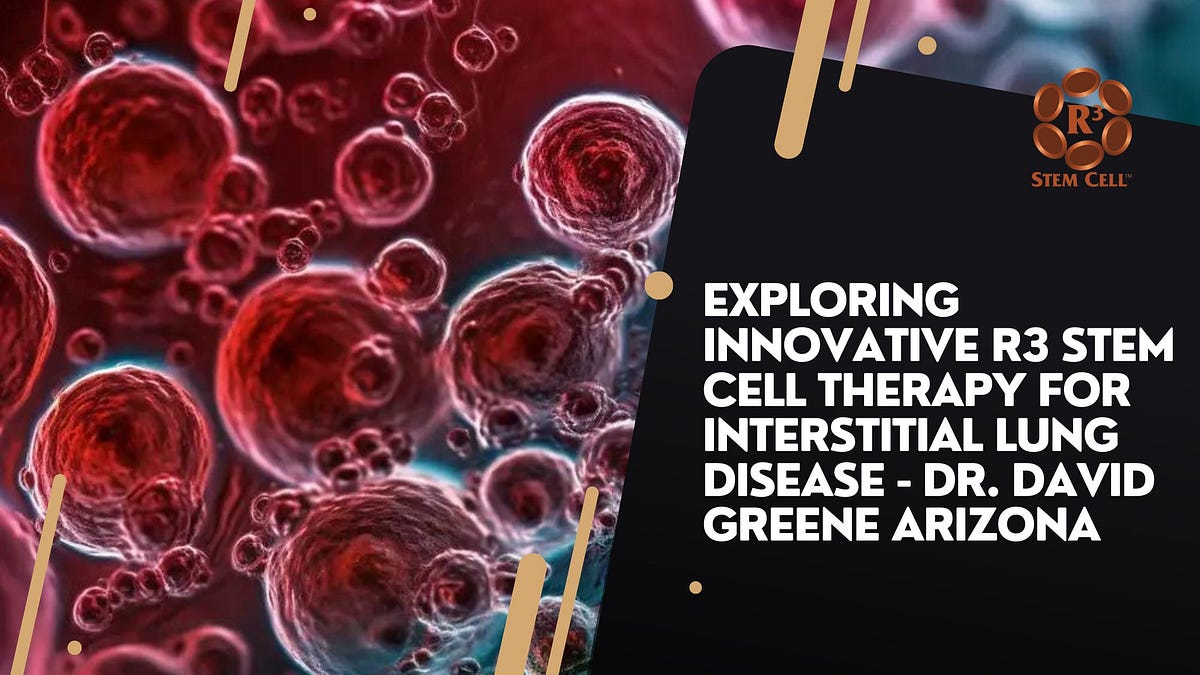Exploring Innovative R3 Stem Cell Therapy for Interstitial Lung Disease ...