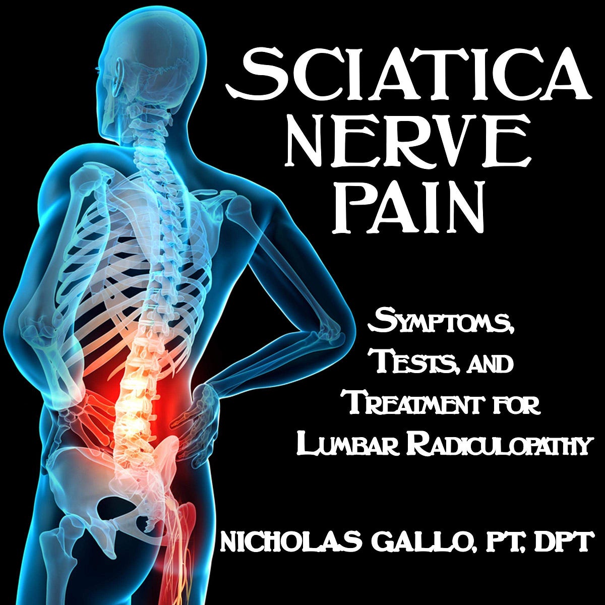 [PDF]-Sciatica Nerve Pain: Symptoms, Tests, and Treatments for Lumbar ...