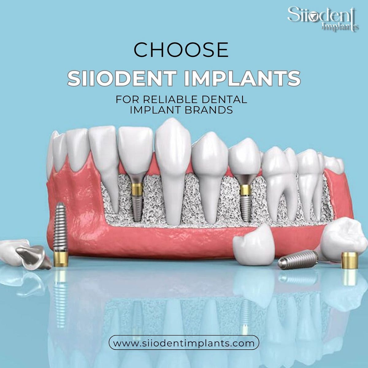 Best Conical Connection for Dental Stability - Siiodent Implants - Medium