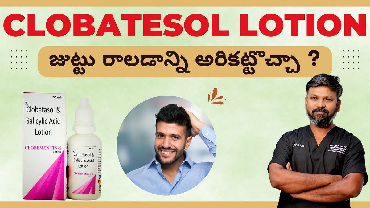 Is It Safe To Use Clobetasol Lotion On My Scalp For Hair Growth And Hair Fall Control By Dr