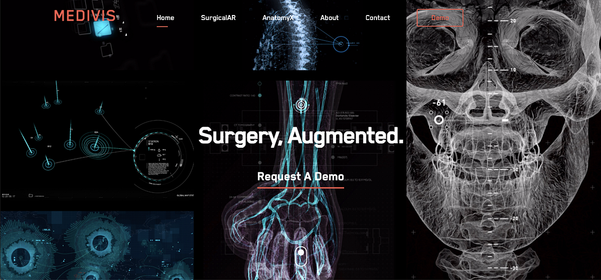 MEDIVIS CES. Medivis is a virtual XR 3D model of an… | by Chris ...