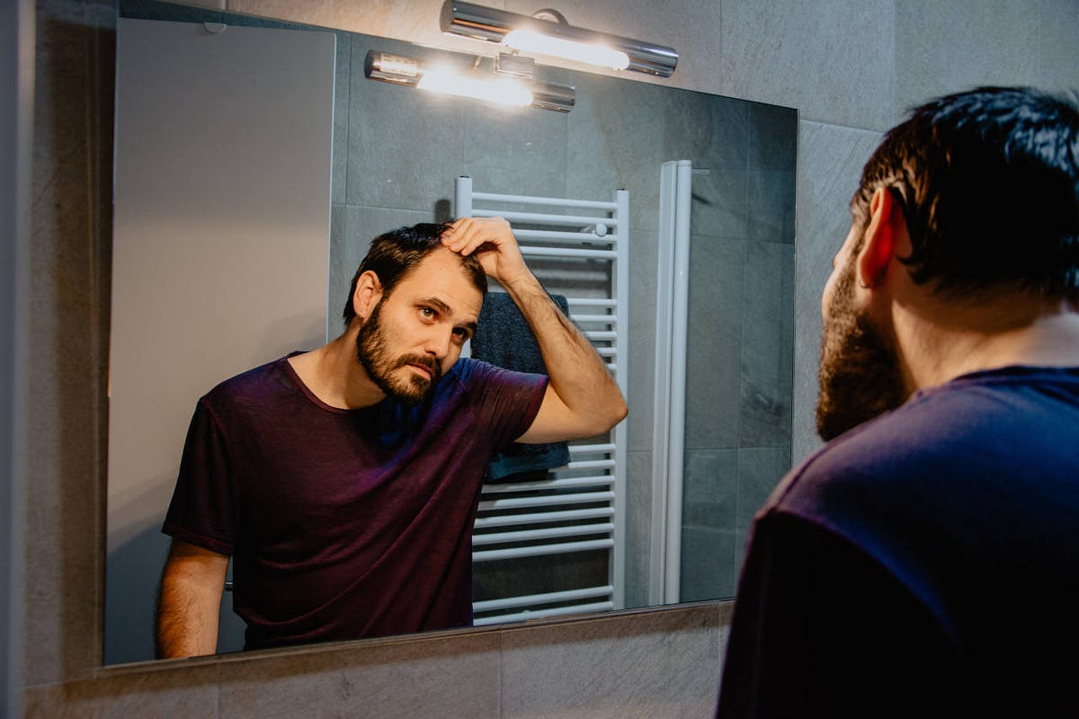 How to know if you need a hair transplant, and how to make sure it’s a ...