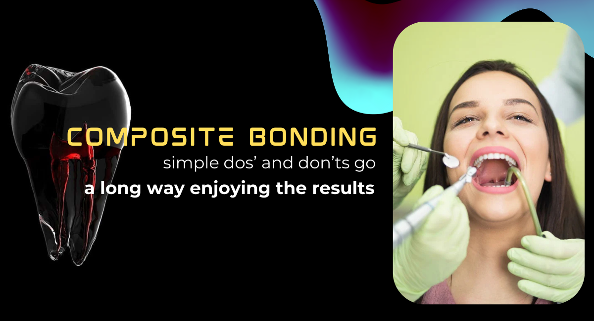 Composite bonding — simple dos’ and don’ts go a long way enjoying the ...