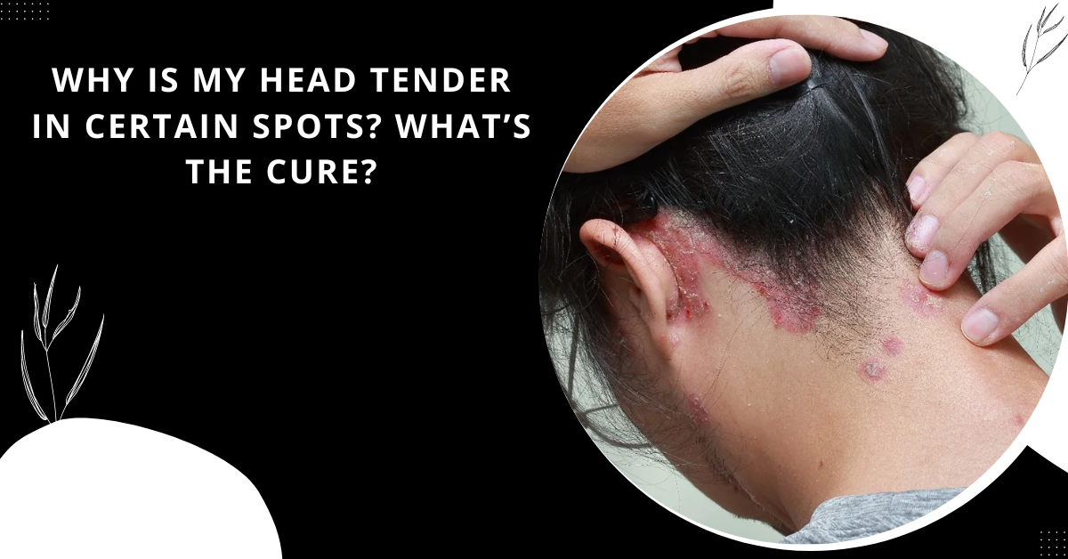 Why is My Head Tender in Certain Spots? What’s The Cure? | by James ...