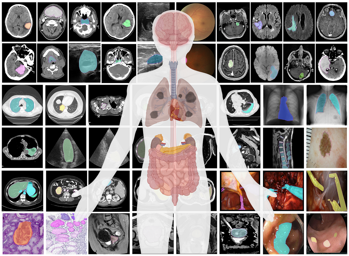 Adapt Segment Anything for Medical Image Segmentation | by Juneta Tao ... Adapt Segment Anything for Medical Image Segmentation | by Juneta Tao ...