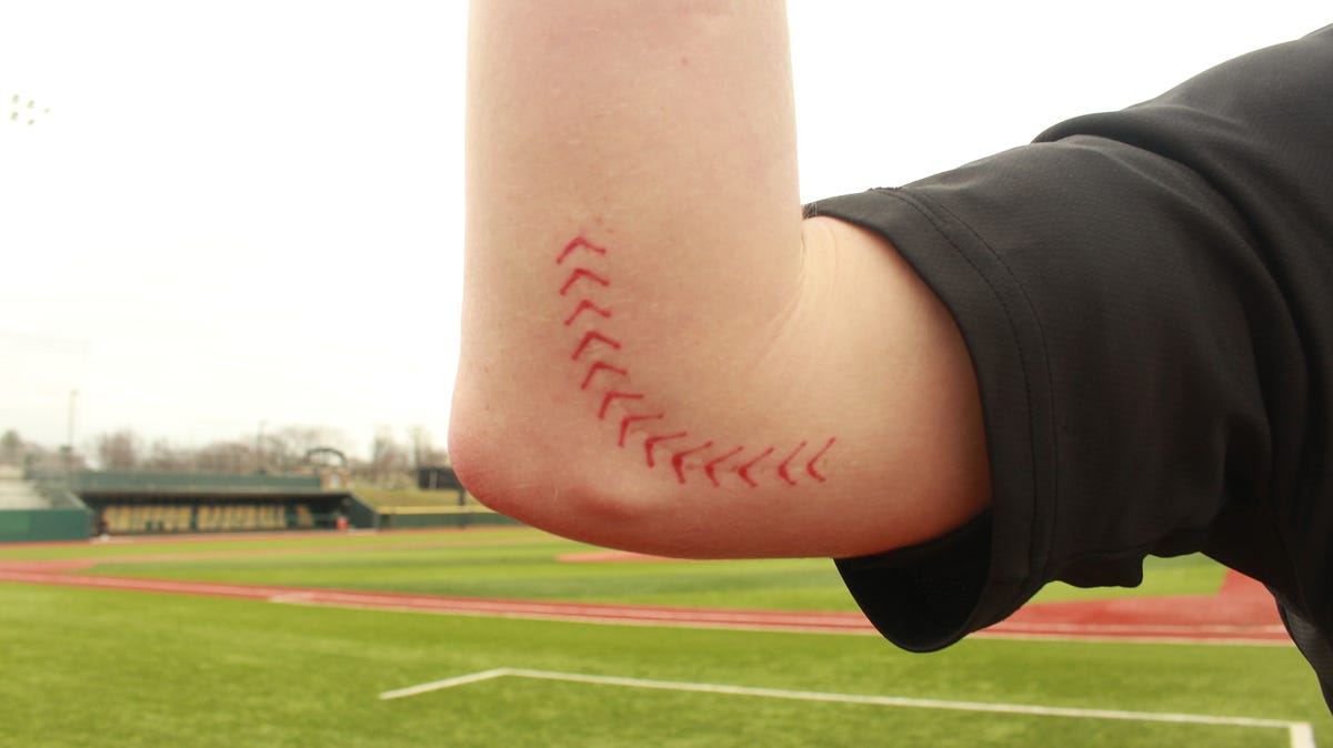 The Nightmare Injury For Baseball Players | by Bailey Ketcham | Medium
