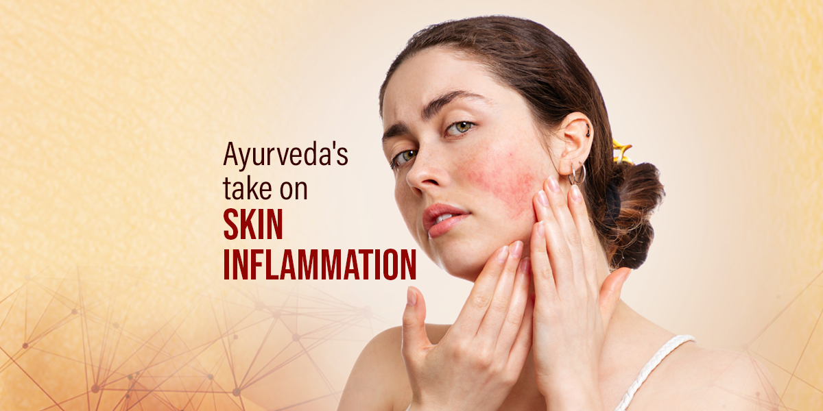 How To Reduce Skin Inflammation The Ayurveda Way | by The Ayurveda ...