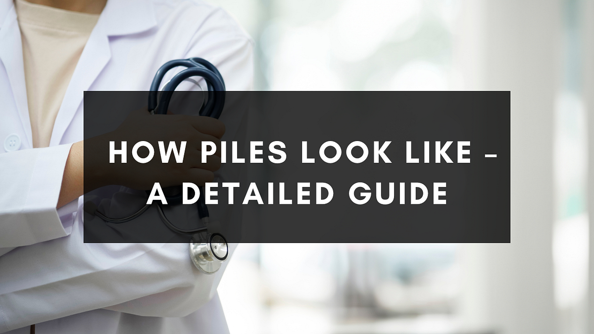 How Piles Look Like -A Detailed Guide. | by Piles Treatment | Jul, 2025 ...