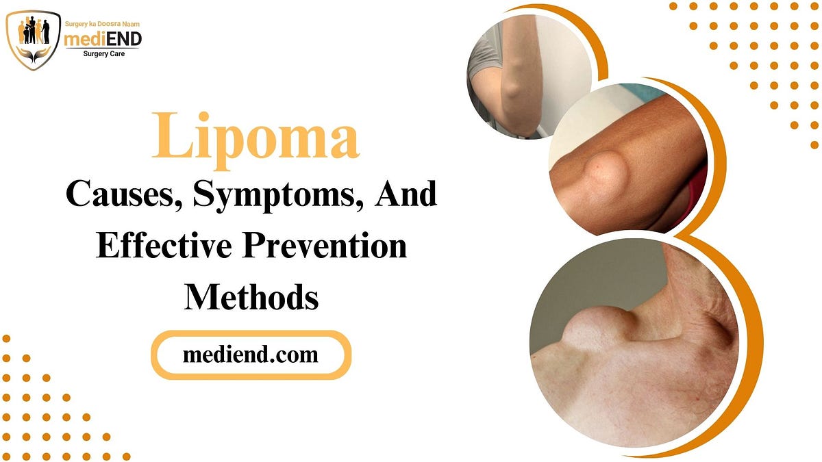 Lipoma Causes, Symptoms, And Effective Prevention Methods | by Mediend ...