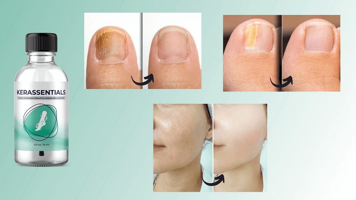 Kerassentials Reviews: Your Guide to Choosing the Right Nail Supplement ...
