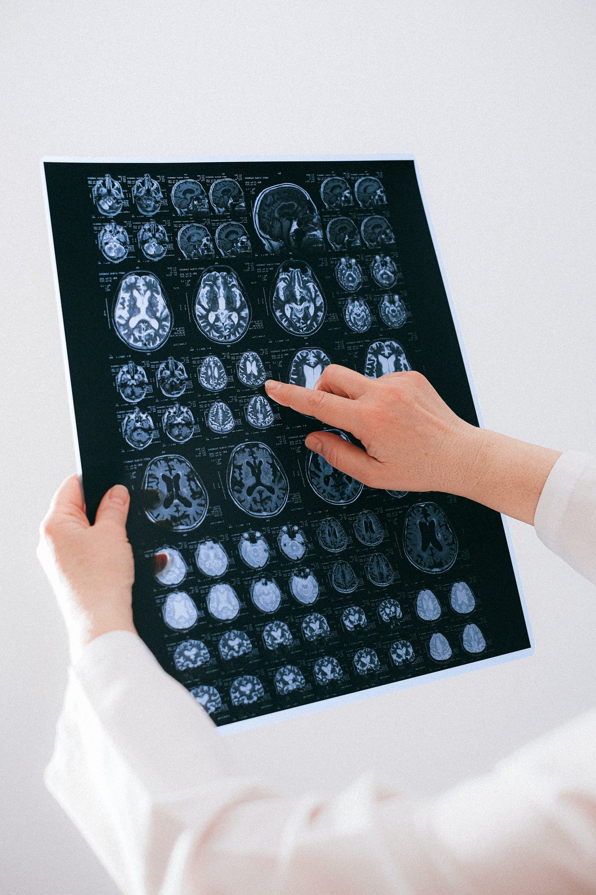 The New Brain Technology Op-Ed That is Smarter Than You | by Opal A ...