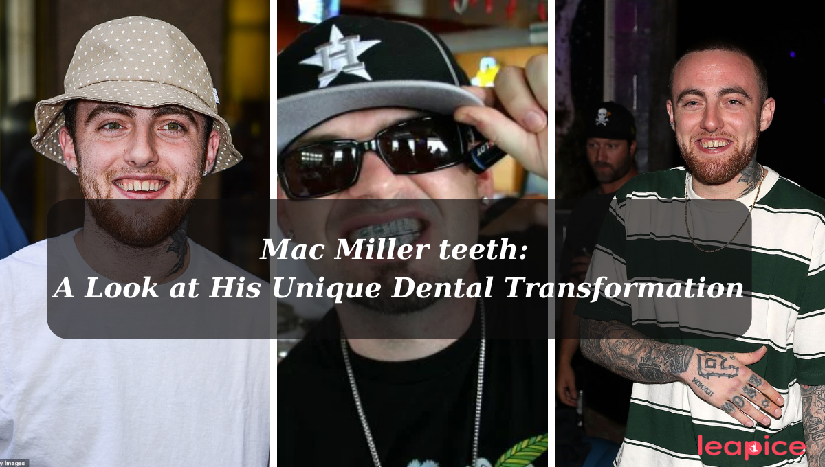 Mac Miller teeth: A Look at His Unique Dental Transformation | by ...