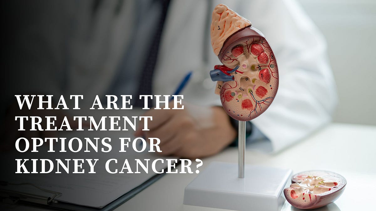 What Are the Treatment Options for Kidney Cancer? | by Sarvesh Joshi ...