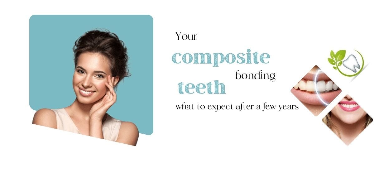 Your composite bonding teeth — what to expect after a few years - Smile ...
