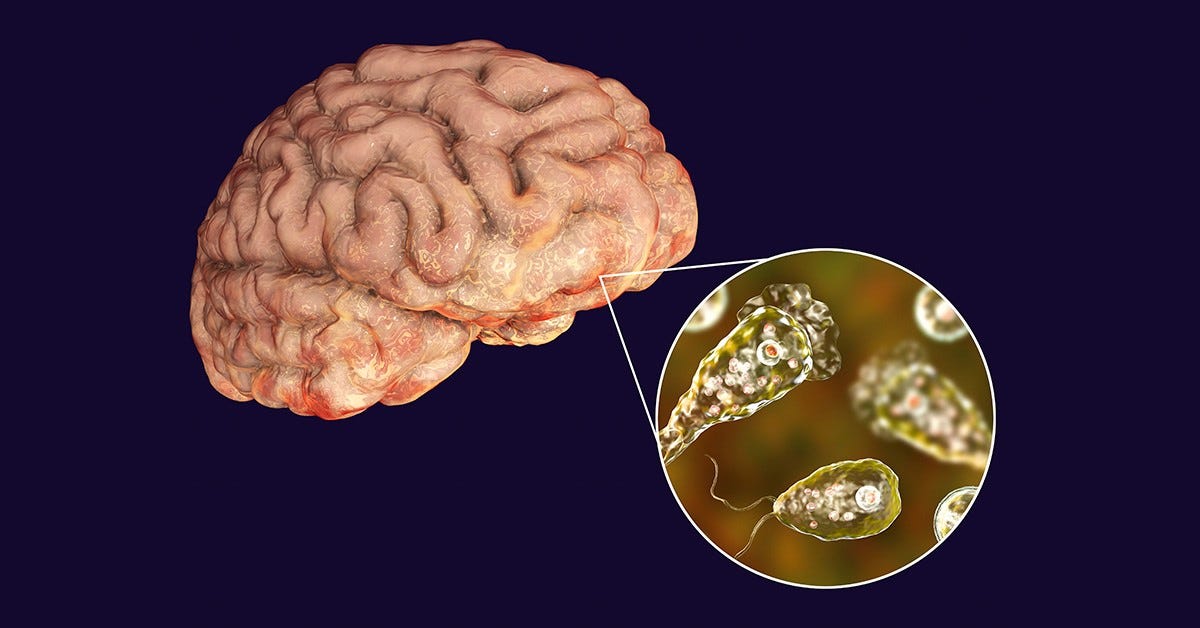 Brain Eating Amoeba Symptoms