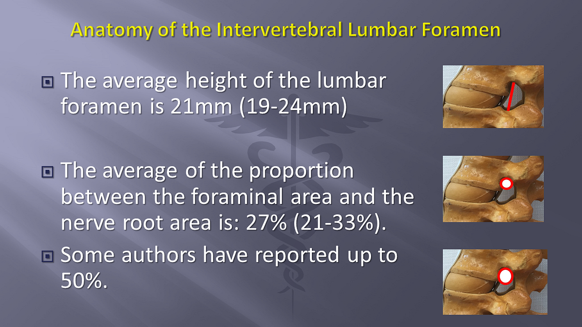 Lumbar Intervertebral Foraminal Anatomy | by Dr Luis Lombardi | Medium