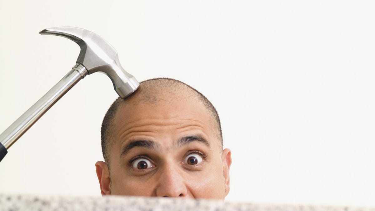 Top 5 incredible 3D printed things | by Smile-Expo | Smile-Expo | Medium