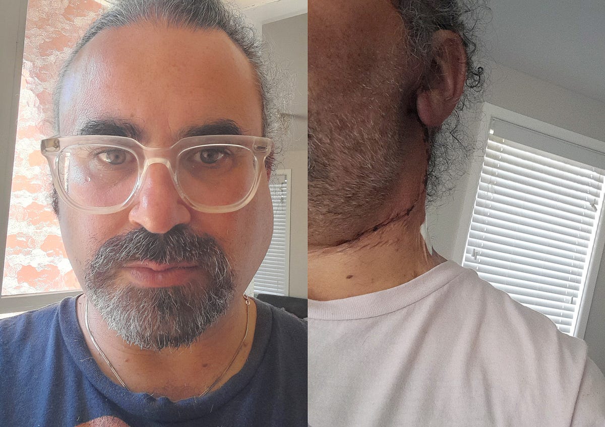 Colin — My Cancerous Friend. It was your typical doctor's room. | by ...