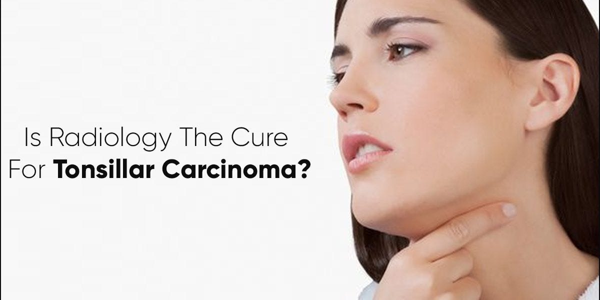 Tonsil cancer symptoms - Dr. Mark D'Andrea - Medium