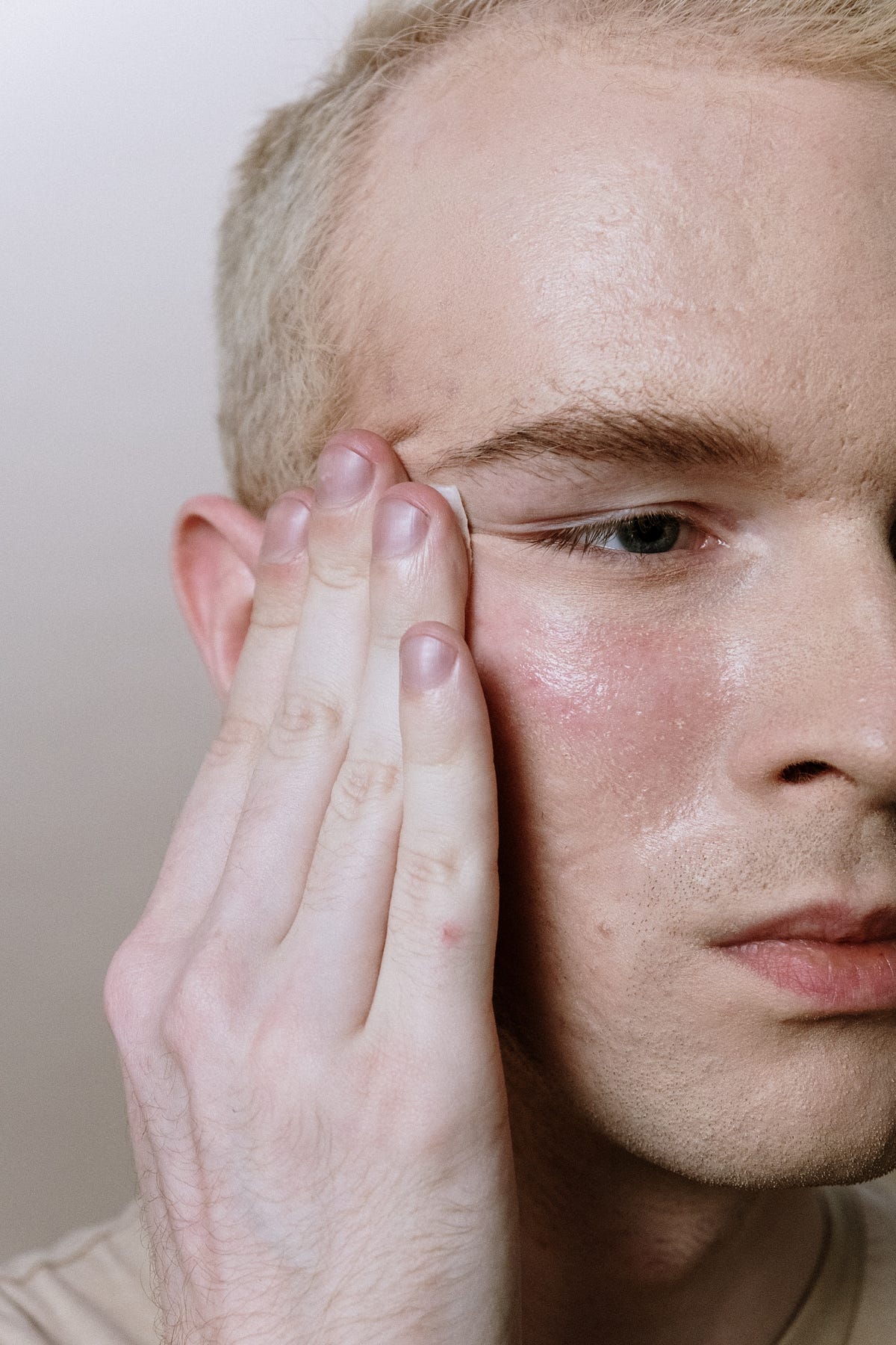 3 Best Tips To Deal With Sudden Acne Breakouts | by Adnan Siddiqui | Medium