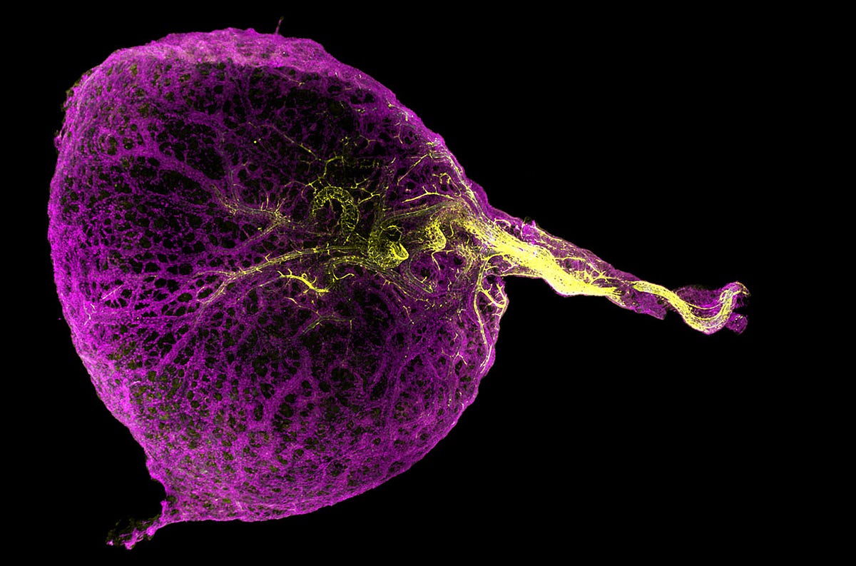 Human Yolk Sacs. AAAS: “Three organs in one? Researchers… | by S. W ...
