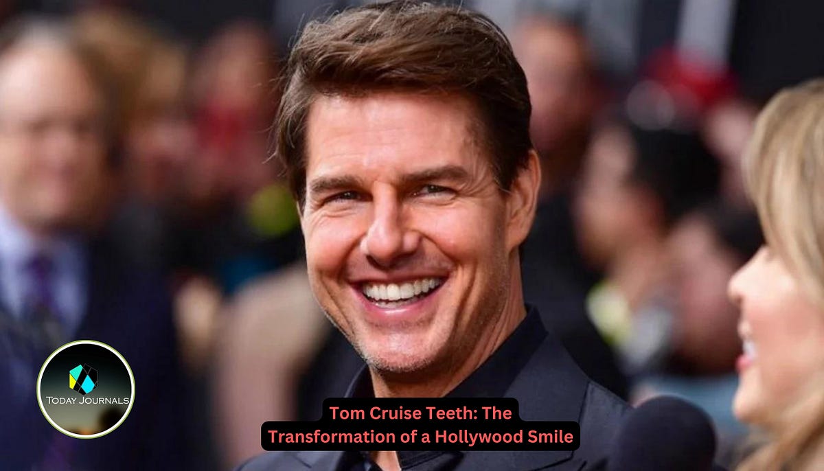Tom Cruise Teeth: The Transformation of a Hollywood Smile | by today ...